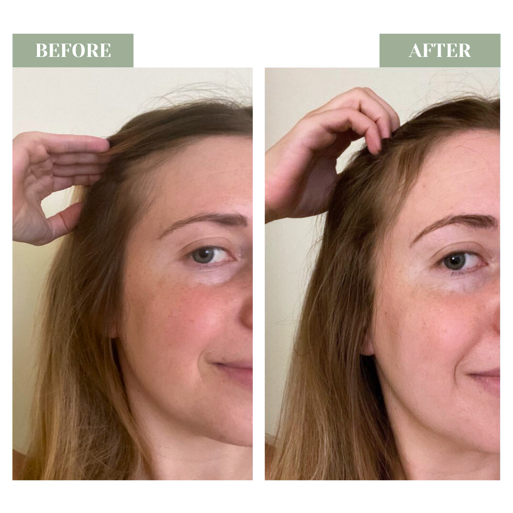 Agent Nateur holi(growth) 84 Advanced Leave-In Growth Scalp Treatment ...