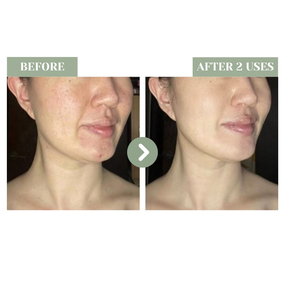 SHEGAIA ARCTIC™ AuraV Face Wrap Mask 煥活V面緊緻再生安瓶面膜 | Ambrosia | 香港