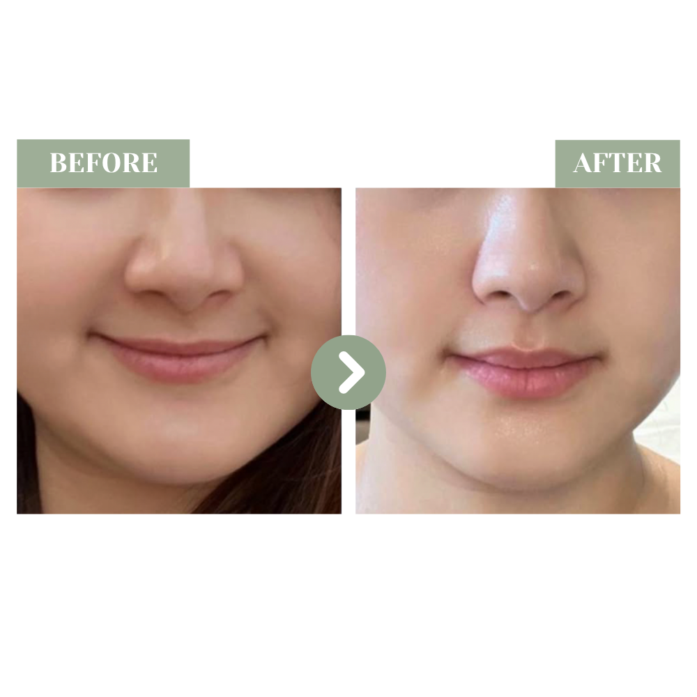 SHEGAIA ARCTIC™ AuraV Face Wrap Mask 煥活V面緊緻再生安瓶面膜 | Ambrosia | 香港